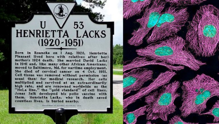 Las células HeLa de Henrietta Lacks. La única persona que consiguió un ...