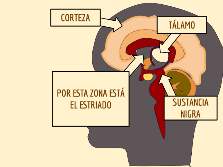 La Enfermedad De Parkinson. Hipocinesia, Síntomas Y Tratamiento.