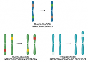 2 Translocaciones Que Debes Conocer: Síndrome De Down Familiar Y ...