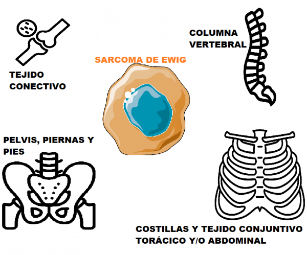 Sarcoma De Ewing: El Sr. Cáncer - Microbacterium