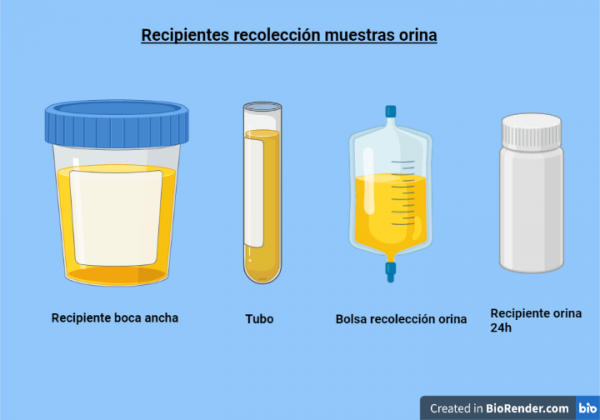 La Orina Y Su Análisis En El Laboratorio Clínico