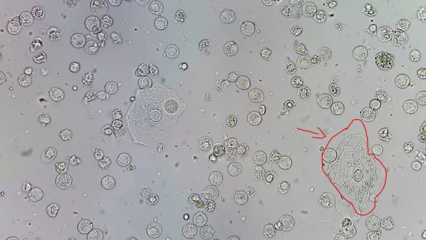 La Orina Y Su Análisis En El Laboratorio Clínico