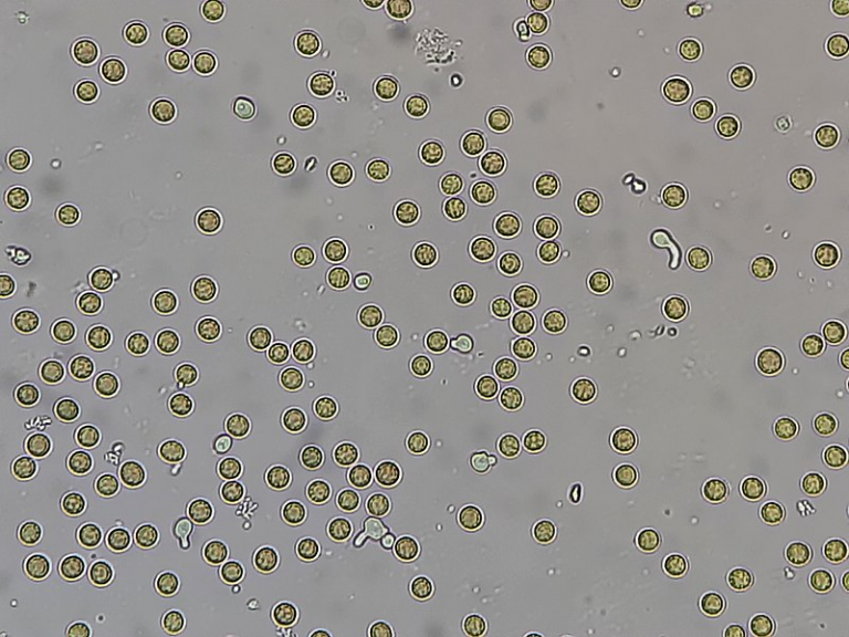 La Orina Y Su Análisis En El Laboratorio Clínico